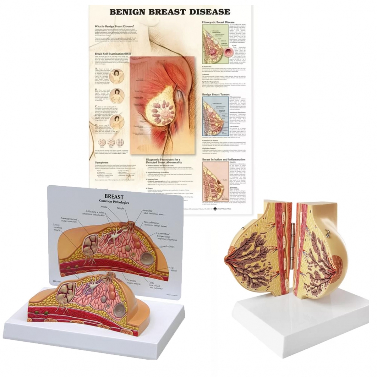 Breast Anatomy & Pathology Bundle - Myaskro